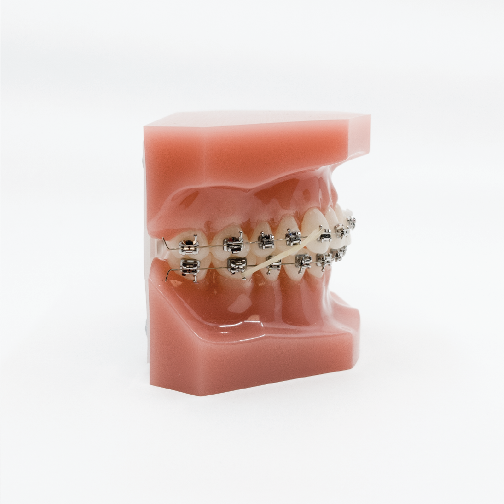 Intra-Oral Latex Elastics 1/4" Light 2.5 ounce (50 Bags)